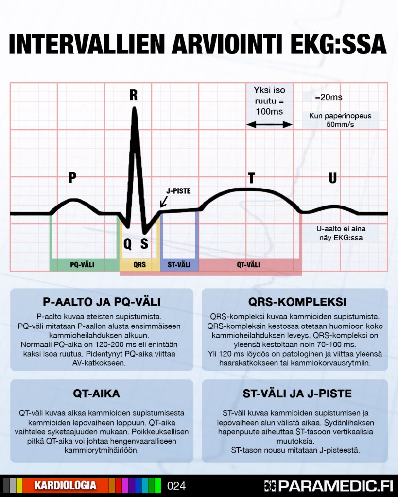 Infograafi 024: Intervallien arviointi EKG:ssa – Paramedic.fi